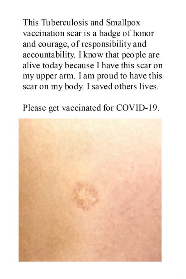 This Tuberculosis and Smallpox vaccination scar is a badge of honor and ...
