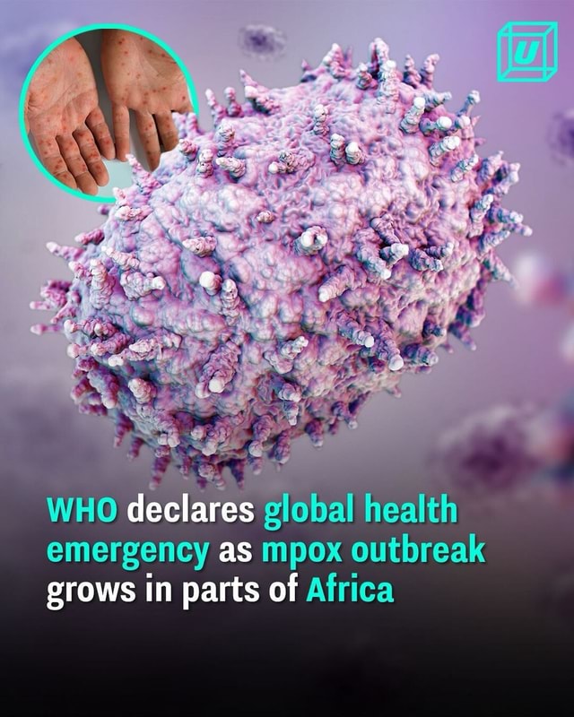 The World Health Organization WHO has labeled the mpox outbreak in ...