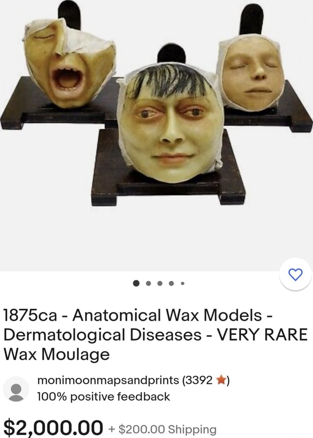 1875ca - Anatomical Wax Models - Dermatological Diseases VERY RARE Wax ...