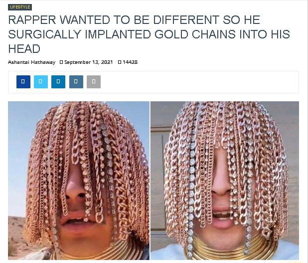RAPPER WANTED TO BE DIFFERENT SO HE SURGICALLY IMPLANTED GOLD CHAINS ...