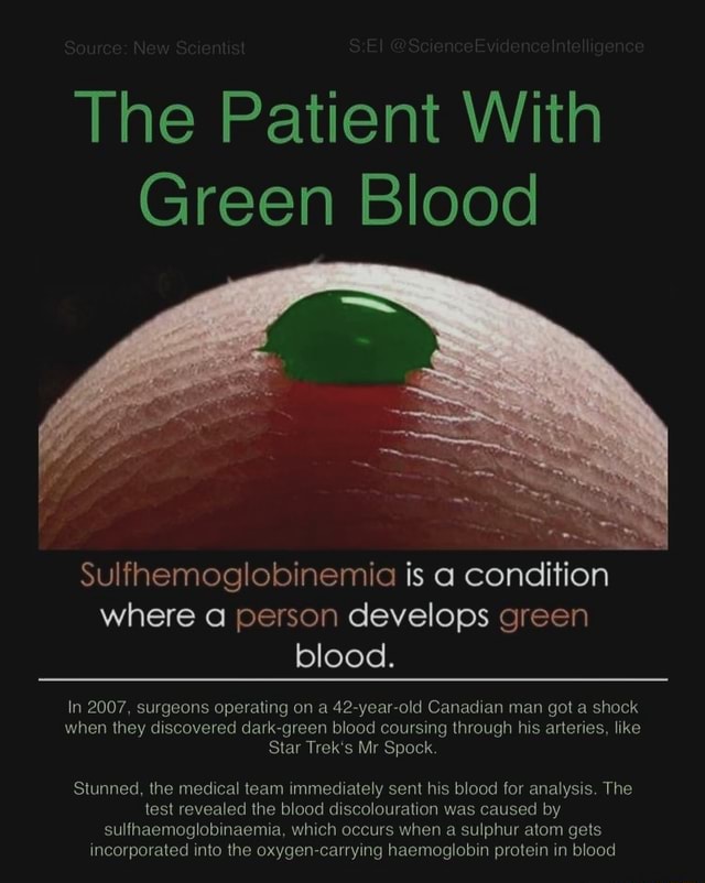 The Patient With Green Blood Sulfhemoglobinemia is a condition where a ...