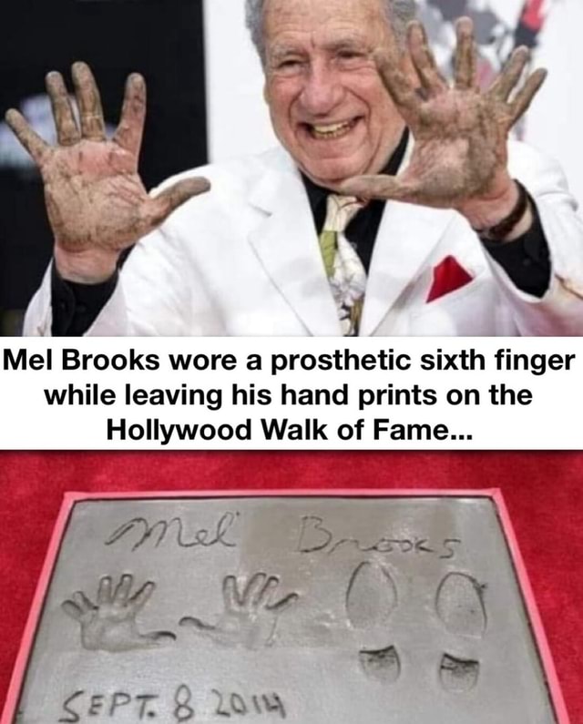 Mel Brooks wore a prosthetic sixth finger while leaving his hand prints ...