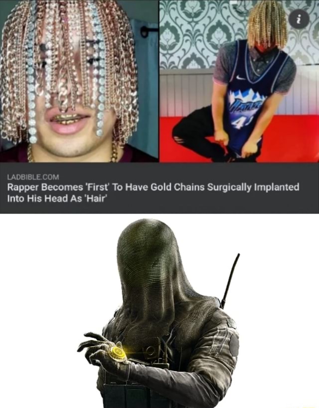 Rapper Becomes First To Have Gold Chains Surgically Implanted Into His ...