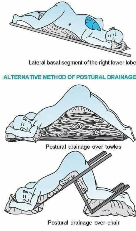 Lateral basal segment of the right lower lobe ALTERNATIVE METHOO OF ...