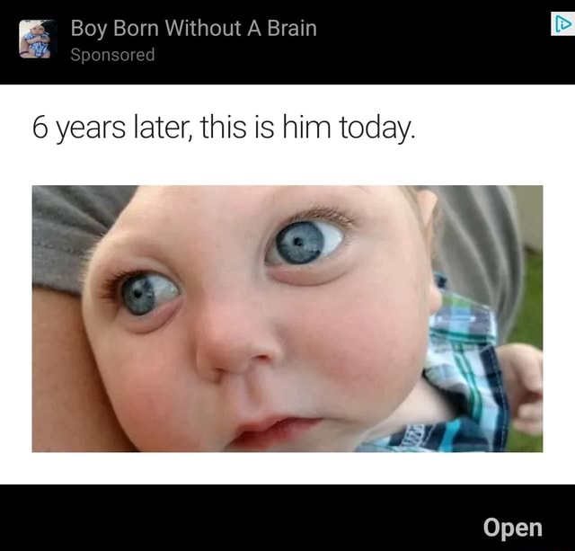 Boy Born Without A Brain Sponsored 6 years later, this is him today ...
