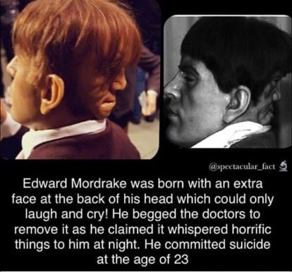 Fact Edward Mordrake was born with an extra face at the back of his ...