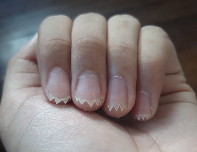 Cursed nails - )