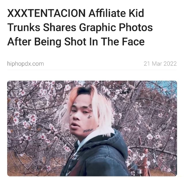XXXTENTACION Affiliate Kid Trunks Shares Graphic Photos After Being ...