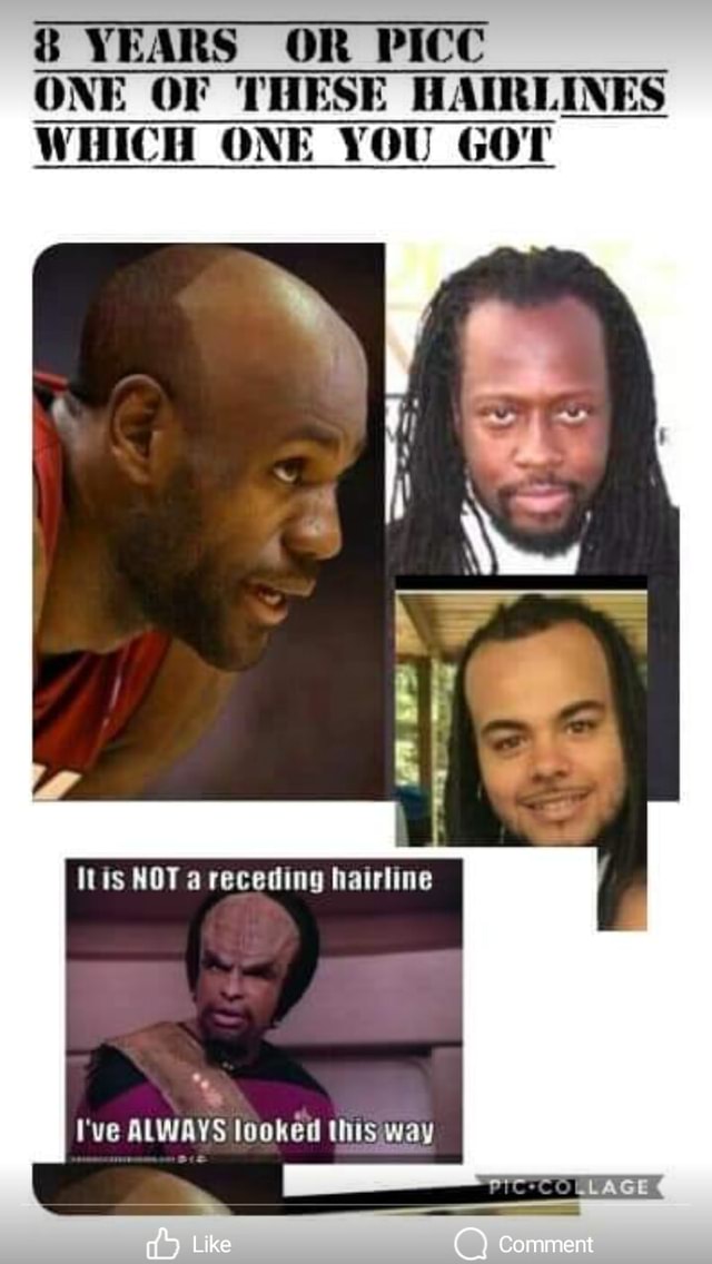 YEARS OR PICC ONE OF THESE HAIRLINES WHICH ONE YOU GOT Itis NOT a ...