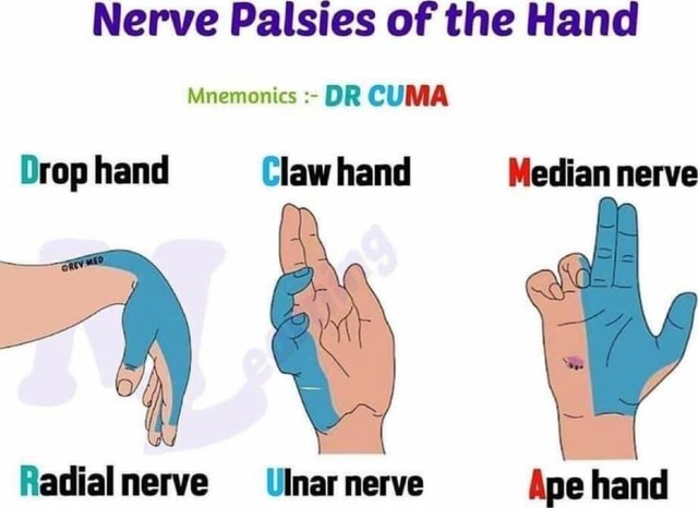 Nerve Palsies of the Hand Mnemonics DR CUMA Drop hand Claw hand Median ...