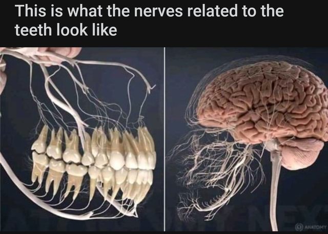 This is what the nerves related to the teeth look like - iFunny
