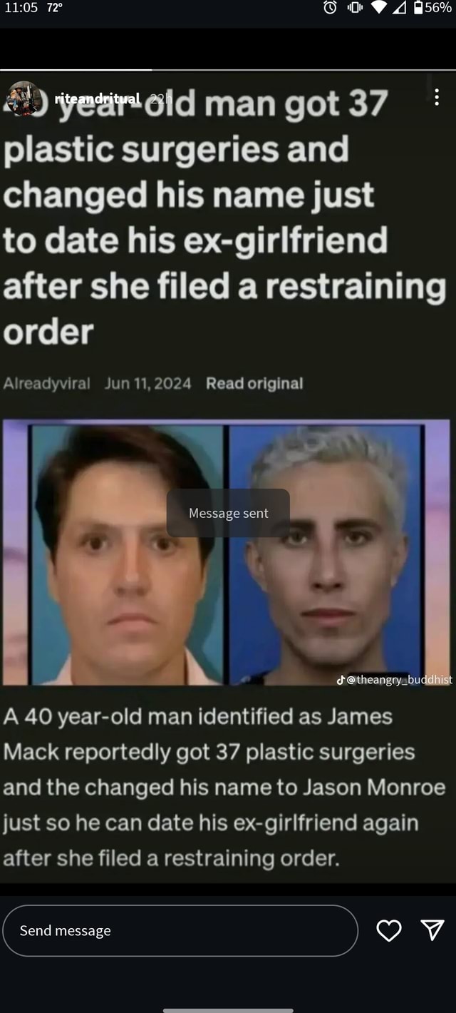 56% riteandritual man got 37 plastic surgeries and changed his name just to date his ex ...