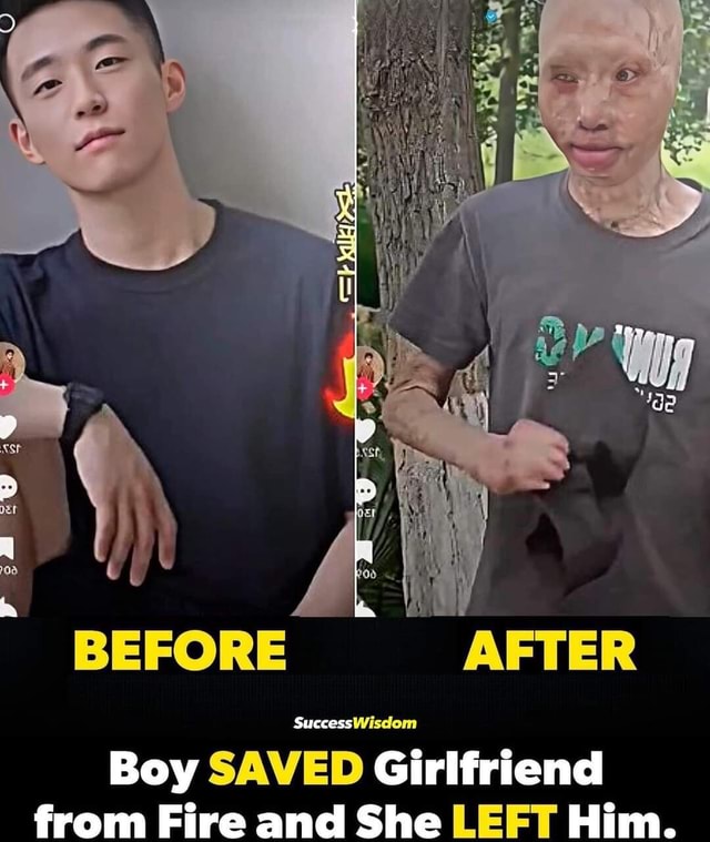 BEFORE AFTER Success Wisdom Boy SAVED Girlfriend from Fire and She LEFT ...