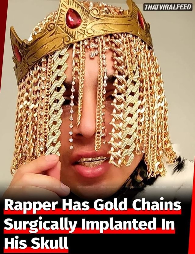 THATVIRALFEED - ' "y ' i at * ' ' ' Rapper Has Gold Chains Surgically ...