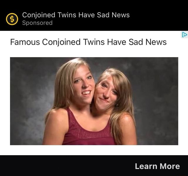 Conjoined Twins Have Sad News Sponsored Famous Conjoined Twins Have Sad ...