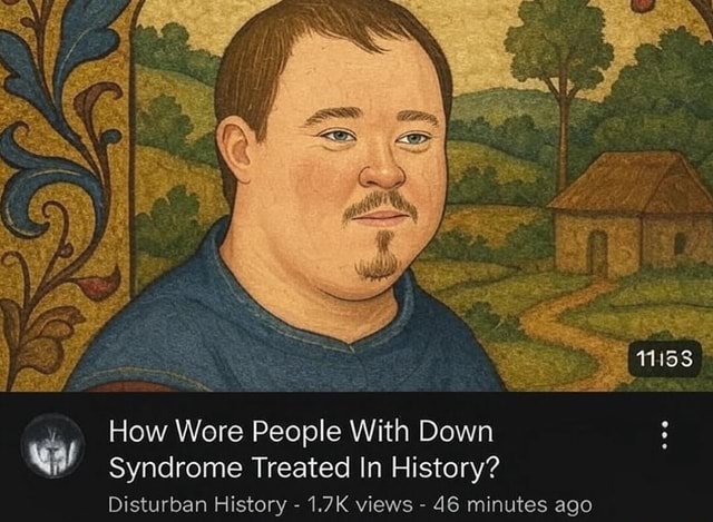 How Wore People With Down Syndrome Treated In History? Disturban ...