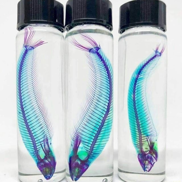 The anatomical diaphanization technique consists in making the soft ...