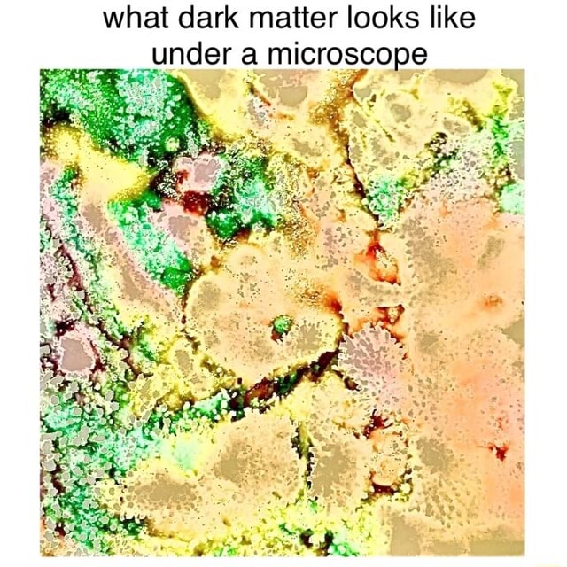 Forbidden Wisdom - what dark matter looks like under a microscope we te ...