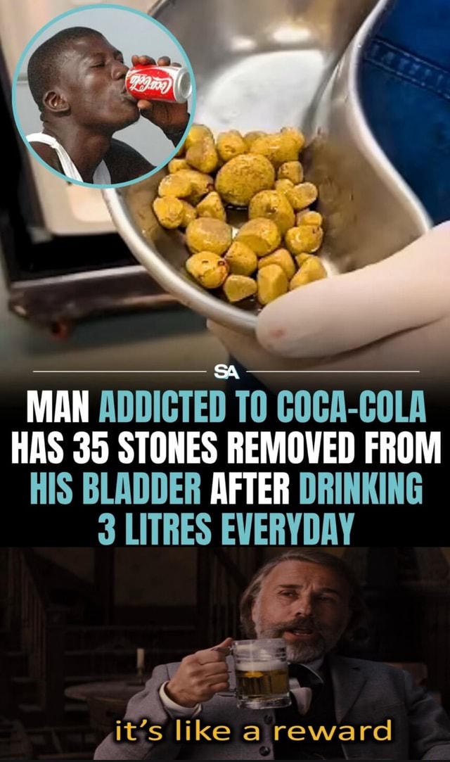 SA MAN ADDICTED TO COCA-COLA HAS 35 STONES REMOVED FROM HIS BLADDER ...