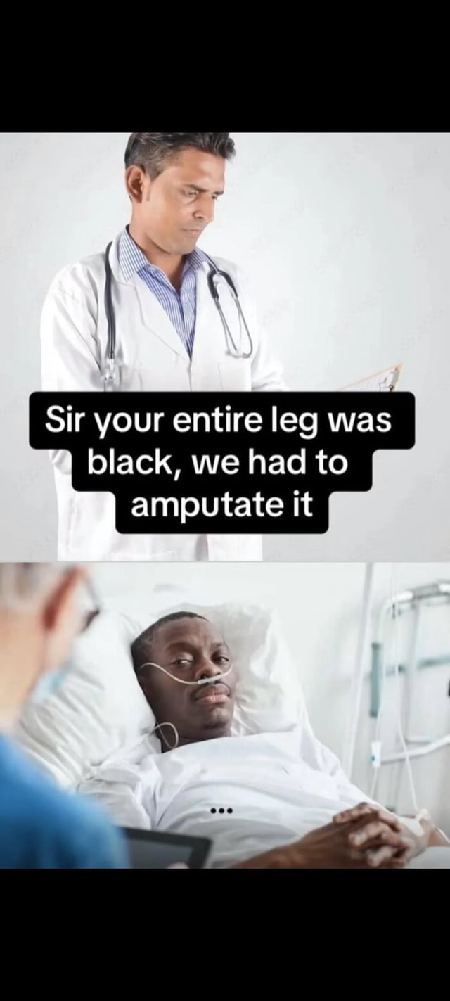 Sir your entire leg was black, we had to amputate it - America’s best ...