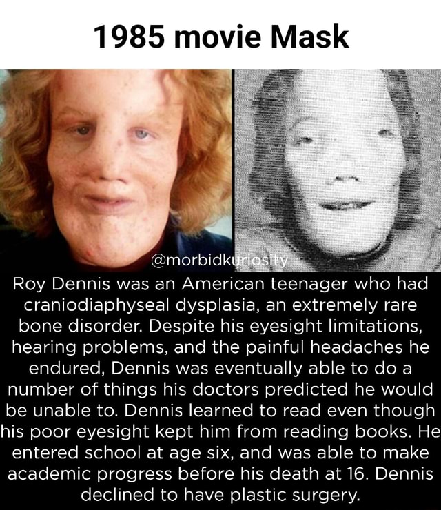1985 movie Mask @morbidkuriosity Roy Dennis was an American teenager ...