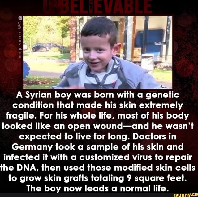 G ois Image source: source: BBC BBC A Syrian boy was born with a ...