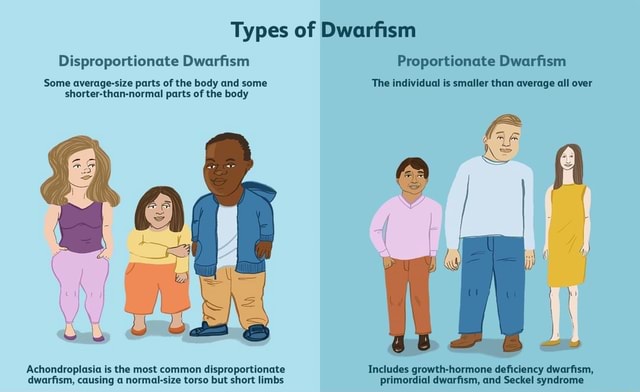 Types of Dwarfism Disproportionate Dwarfism Some average-size parts of ...