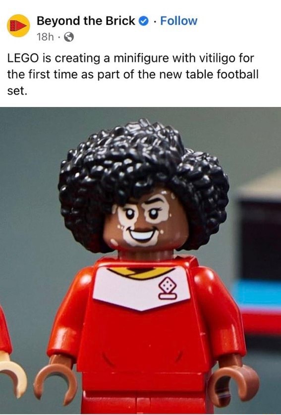 Beyond the Brick @ - Follow LEGO is creating a minifigure with vitiligo ...