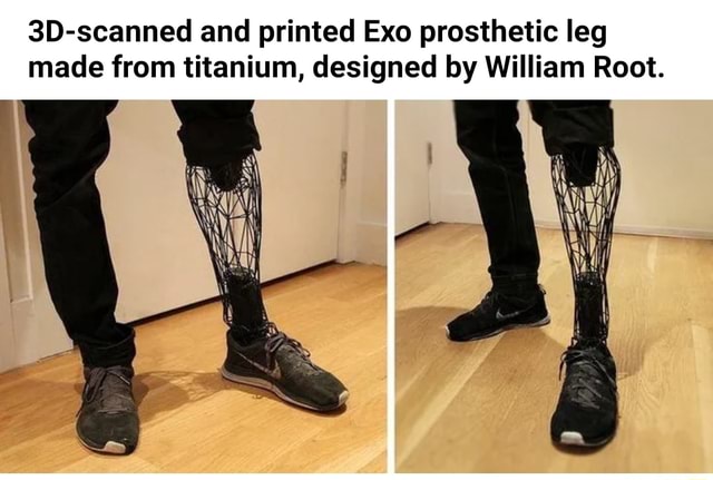 3D-scanned and printed Exo prosthetic leg made from titanium, designed ...