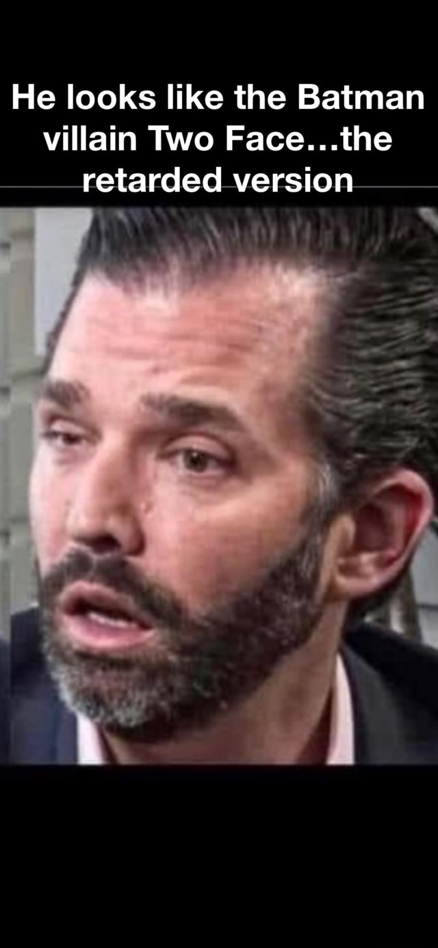 He looks like the Batman villain Two Face...the retarded version ...