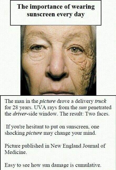 The importance of wearing sunscreen every day The man in the picture ...