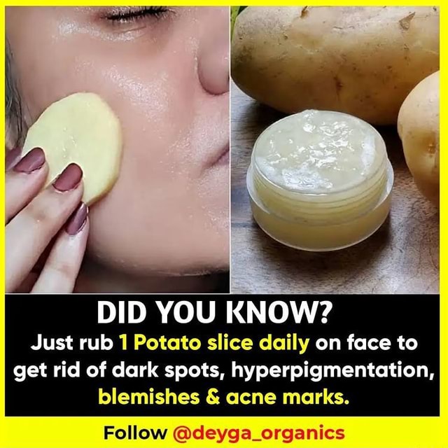 DID YOU KNOW? Just rub 1 Potato slice daily on face to get rid of dark ...