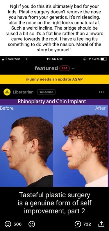 Ngl if you do this it's ultimately bad for your kids. Plastic surgery ...