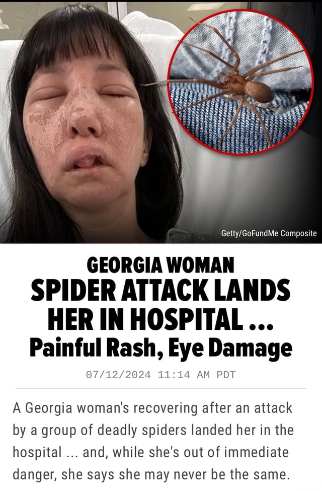 Composite GEORGIA WOMAN SPIDER ATTACK LANDS HER IN HOSPITAL... Painful ...