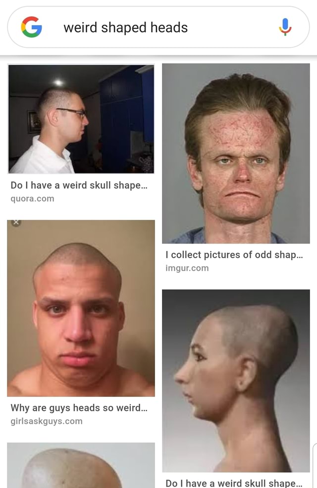 G weird shaped heads Do I have a weird skull shape... quora.com I ...