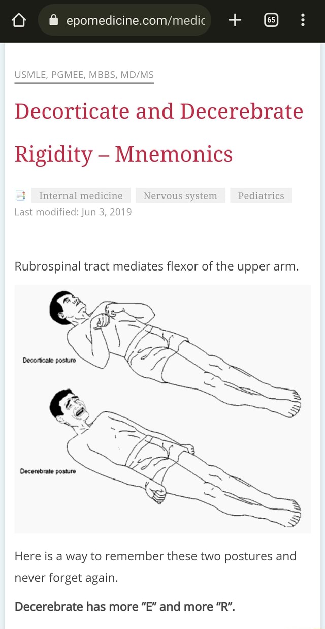 Q @ + USMLE, PGMEE, MBBS, Decorticate and Decerebrate Rigidity ...