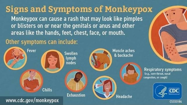Signs and Symptoms of Monkeypox Monkeypox can cause a rash that may ...