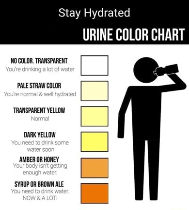 Stay Hydrated URINE COLOR CHART NO COLOR. TRANSPARENT PALE STRAW COLOR ...