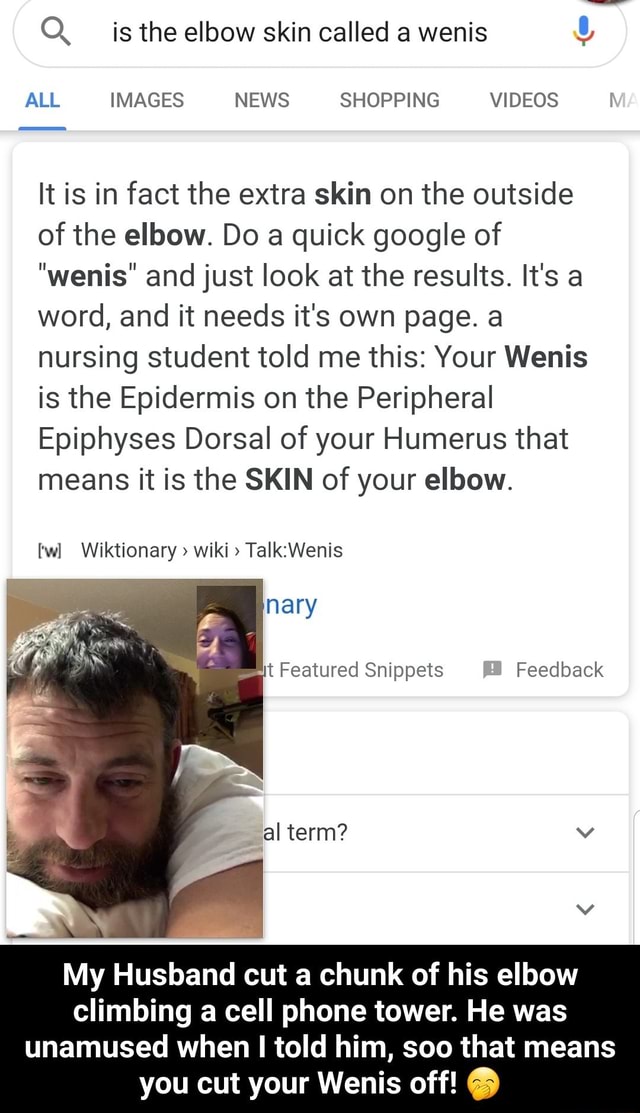 Q is the elbow skin called a wenis !; It is in fact the extra skin on ...