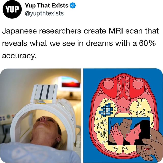 Yup That Exists @yupthtexists Japanese researchers create MRI scan that ...