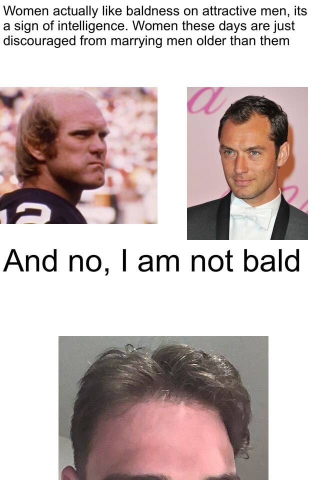 Women actually like baldness on attractive men, its a sign of ...