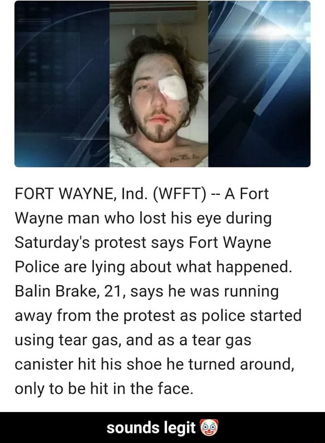 A Fort Wayne man who lost his eye during Saturday's protest says Fort ...