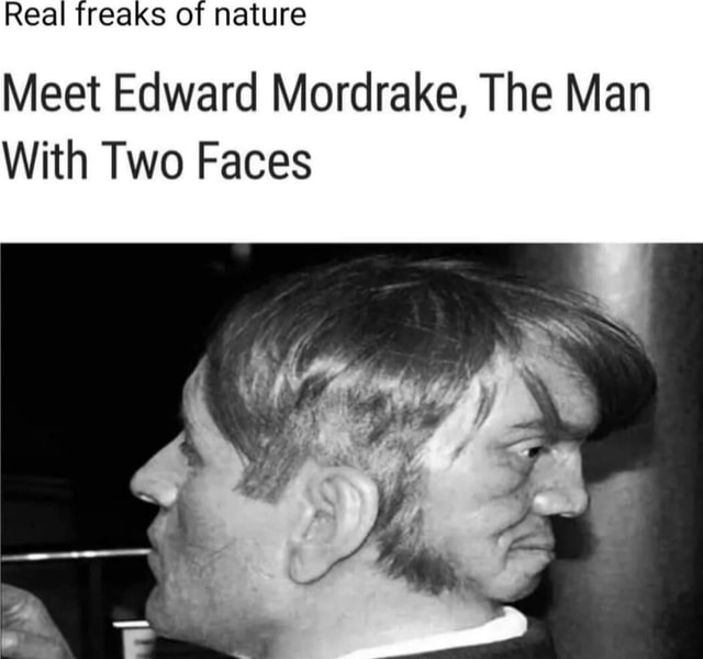 Real freaks of nature Meet Edward Mordrake, The Man With Two Faces ...