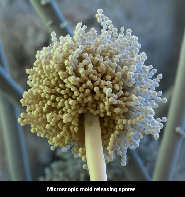 Microscopic mold releasing spores. - Microscopic mold releasing spores. - )