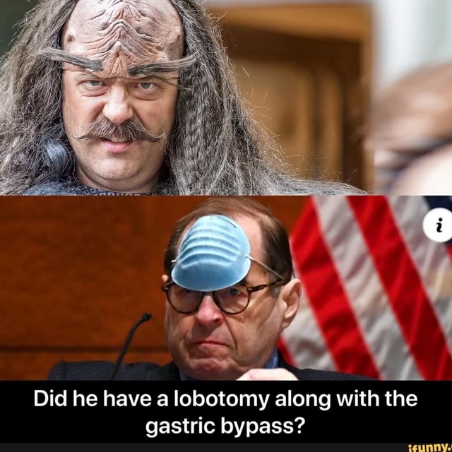 Did he have a lobotomy along with the gastric bypass? - iFunny