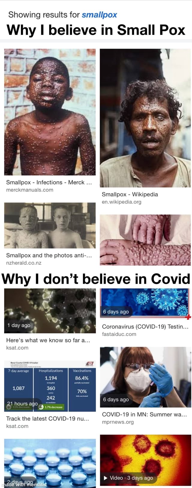 Showing results for smallpox Why believe in Small Pox Smallpox ...