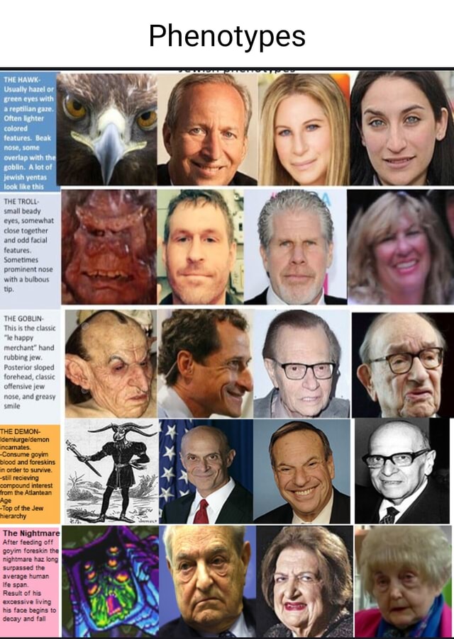 Phenotypes gore of Jow features Sometimes prominent nose with a bulbous ...