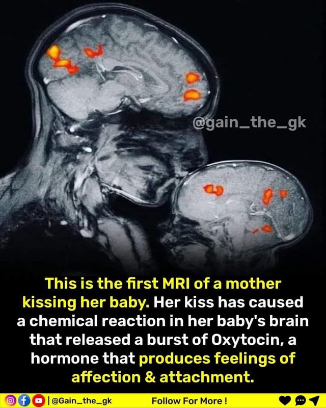 This is the first MRI of a mother kissing her baby. Her kiss has caused ...