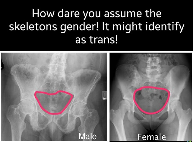 How dare you assume the skeletons gender! It might identify as trans ...