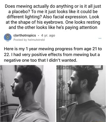 Does mewing actually do anything or is it all just a placebo? To me it ...